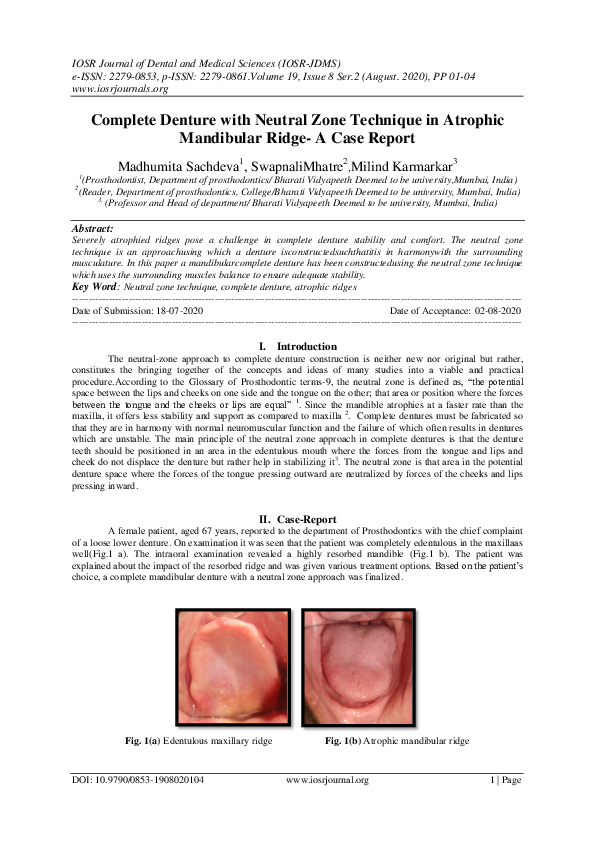 (PDF) Complete Denture with Neutral Zone Technique in Atrophic ...