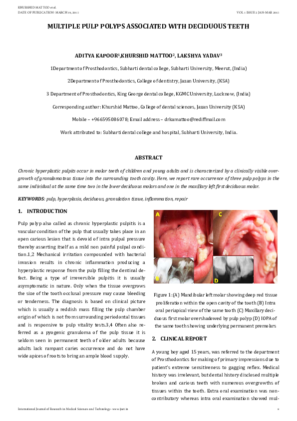 (PDF) Multiple pulp polyps associated with deciduous teeth.