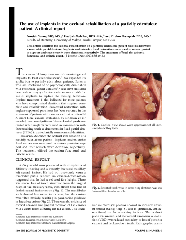 (PDF) The use of implants in the occlusal rehabilitation of a partially ...