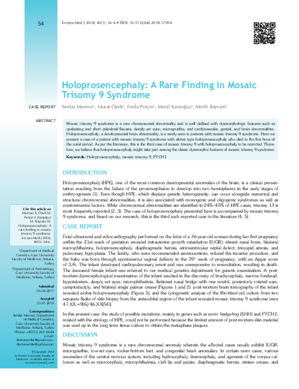 (PDF) Holoprosencephaly, proboscis and anophthalmia in a foetus with ...