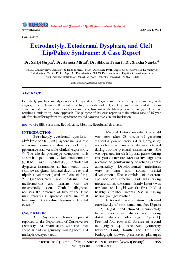Pdf Ectrodactyly Ectodermal Dysplasia And Cleft Lip Palate Syndrome A Case Report