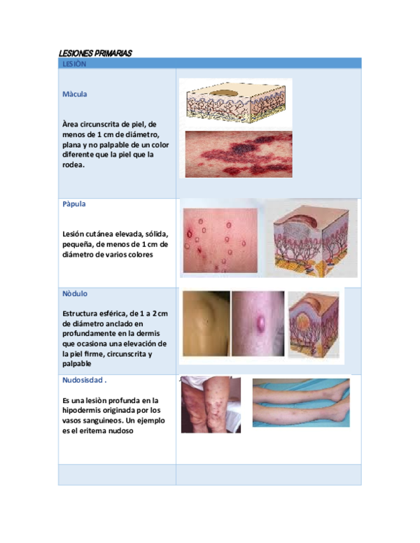 (DOC) LESIONES PRIMARIAS LESIÒN Màcula