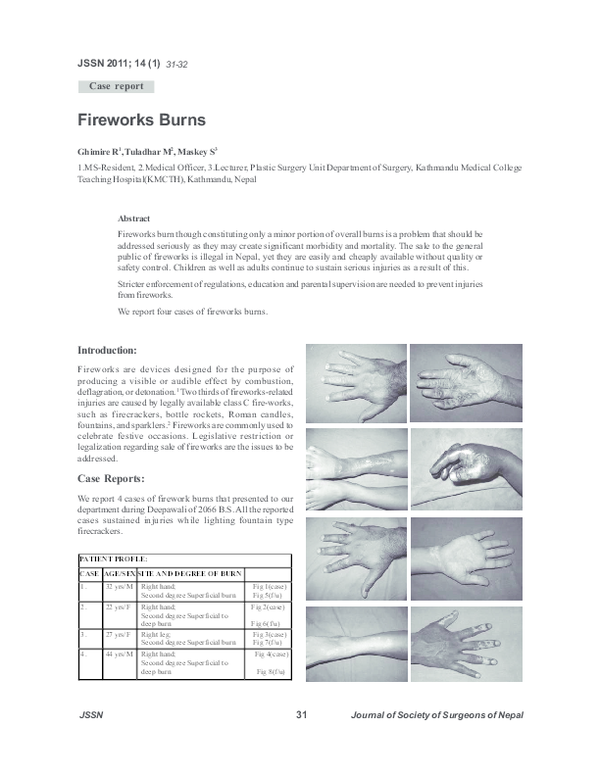 (PDF) Fireworks burns | Dr Roshan Ghimire - Academia.edu