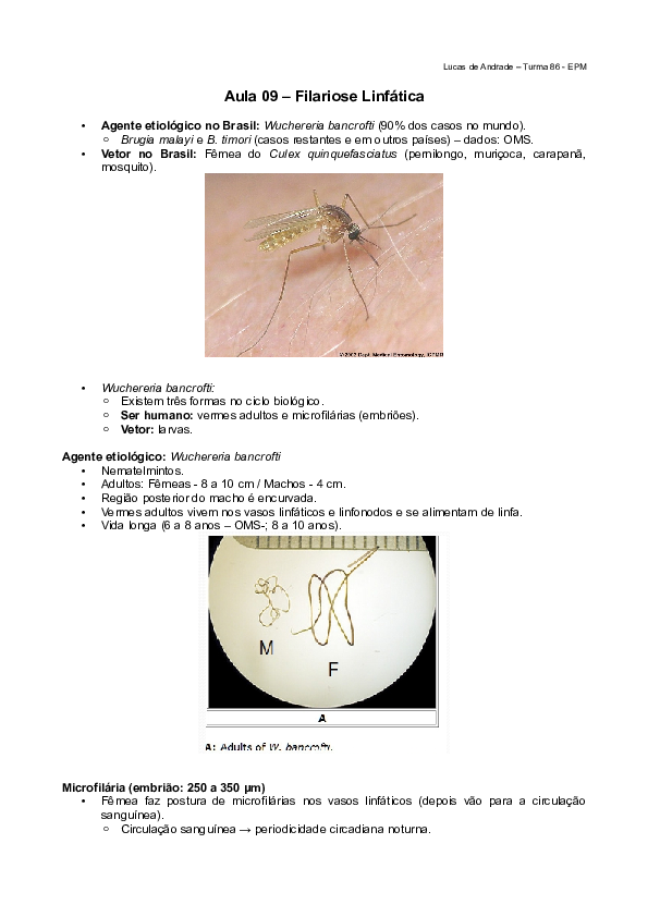 (PDF) Aula 09 Filariose Linfática