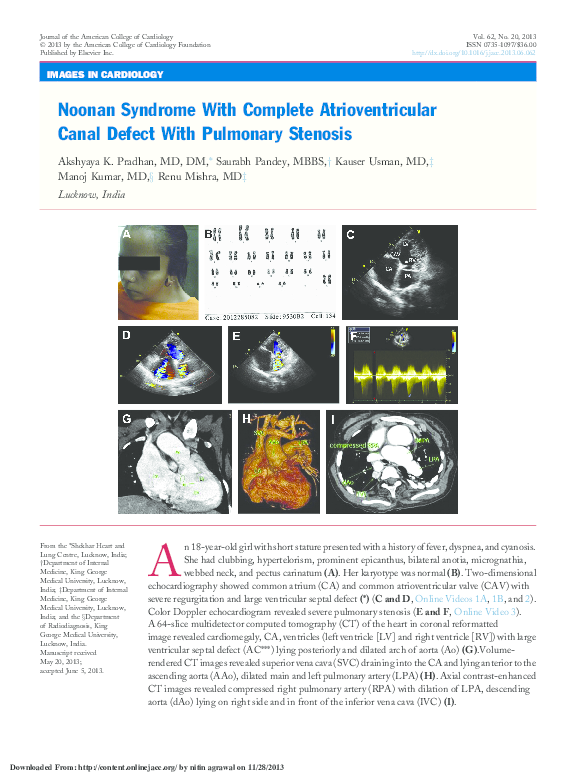 (PDF) Noonan Syndrome With Complete Atrioventricular Canal Defect With ...