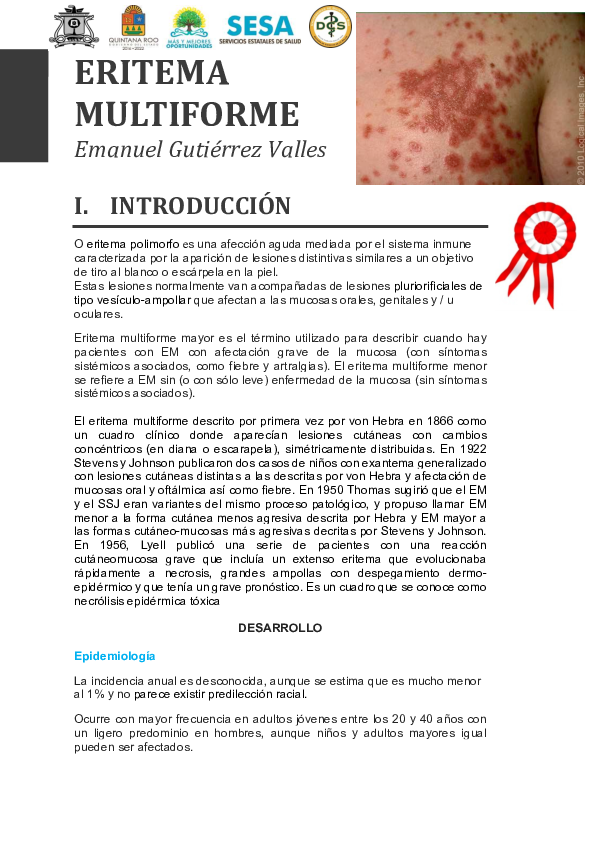 (PDF) ERITEMA MULTIFORME