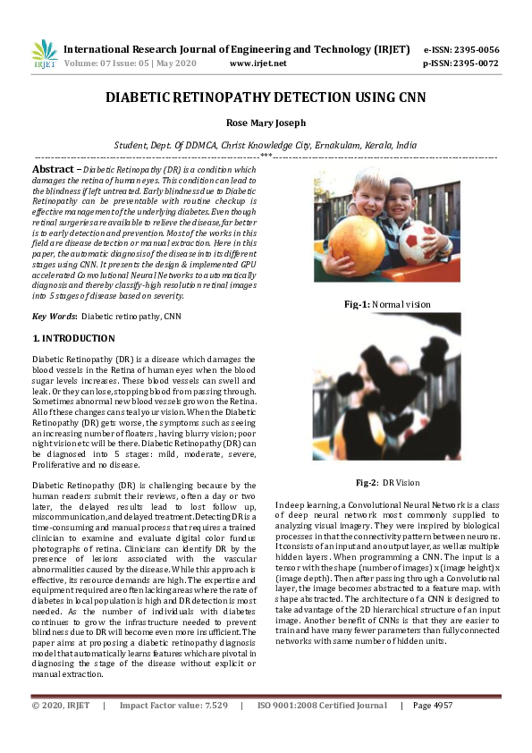 (PDF) IRJET- DIABETIC RETINOPATHY DETECTION USING CNN