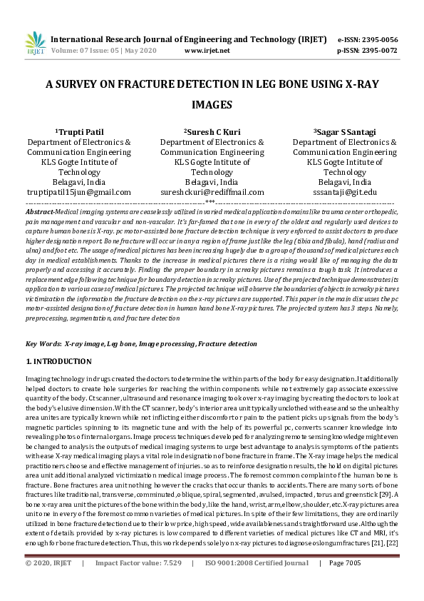 (PDF) IRJET- A SURVEY ON FRACTURE DETECTION IN LEG BONE USING X-RAY IMAGES