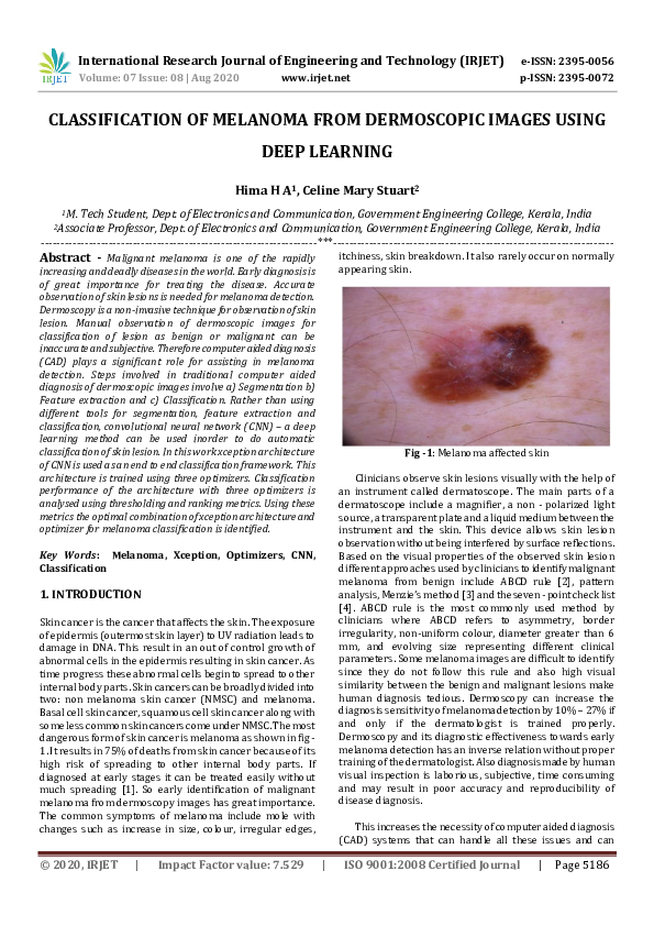 (PDF) IRJET- CLASSIFICATION OF MELANOMA FROM DERMOSCOPIC IMAGES USING ...