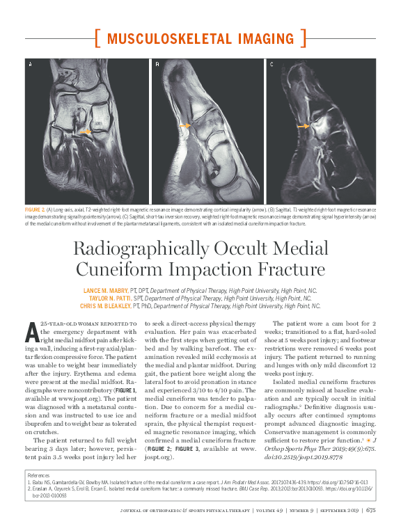 (PDF) Radiographically Occult Medial Cuneiform Impaction Fracture ...