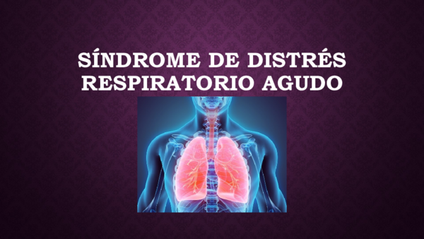 (PPT) Sindrome de Distres Respiratorio Agudo