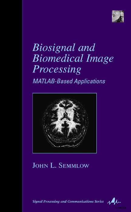 (PDF) Biosignal and Biomedical Image Processing MATLAB based Applications 2004