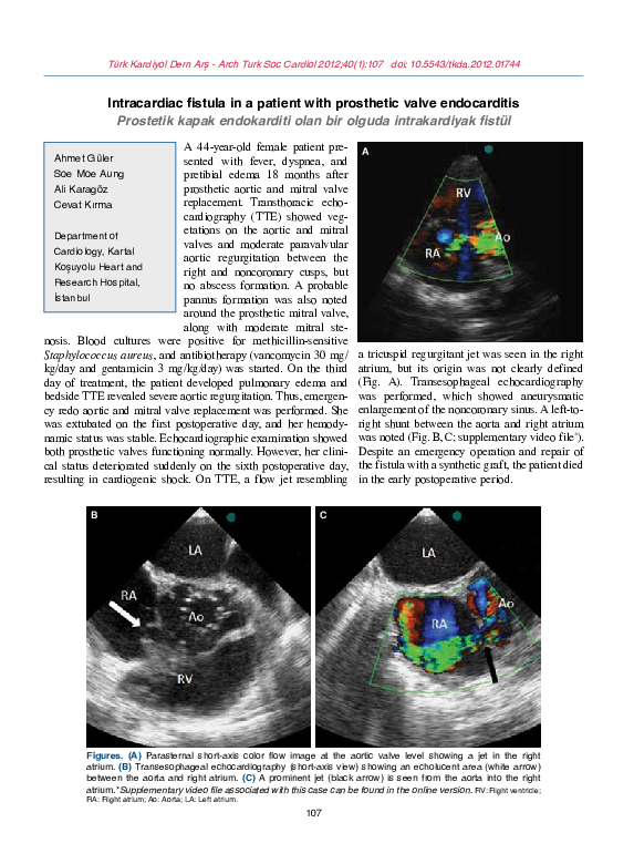 (PDF) Intracardiac fistula in a patient with prosthetic valve endocarditis