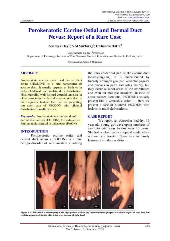 (PDF) Porokeratotic Eccrine Ostial and Dermal Duct Nevus: Report of a ...