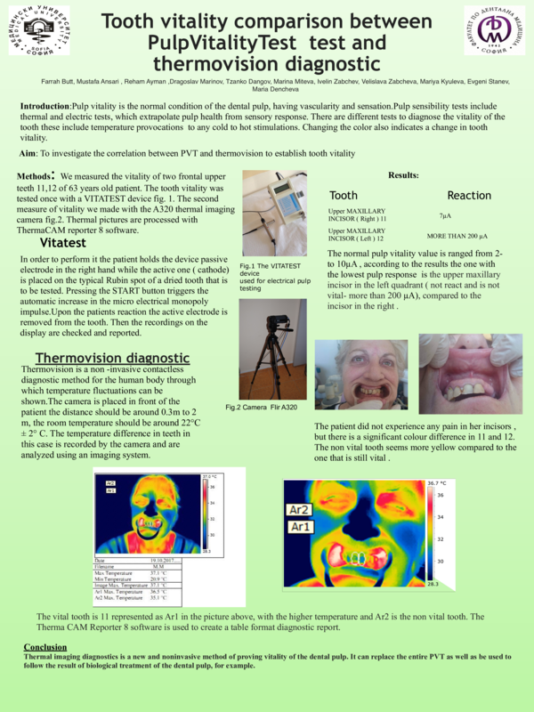 (PDF) Tooth vitality comparison between PulpVitalityTest test and ...