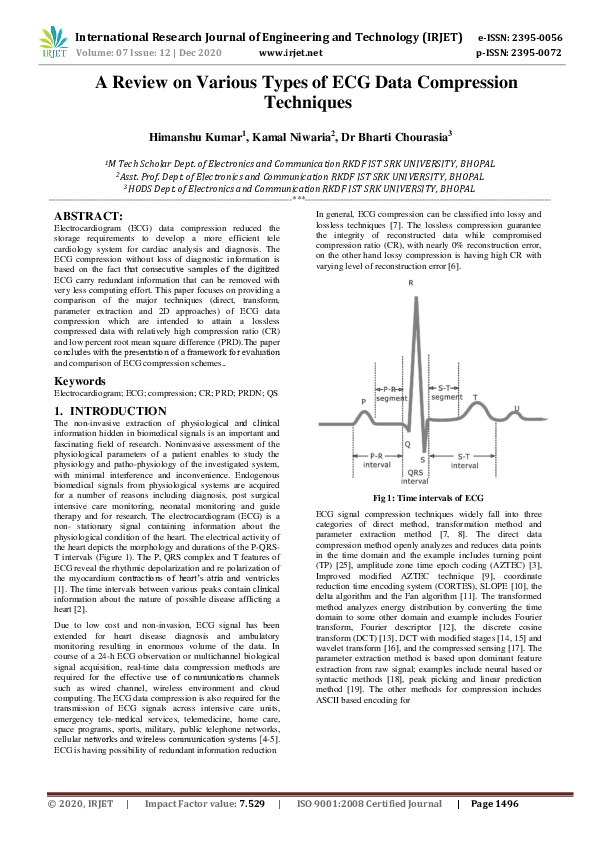 (PDF) IRJET- A Review on Various Types of ECG Data Compression Techniques