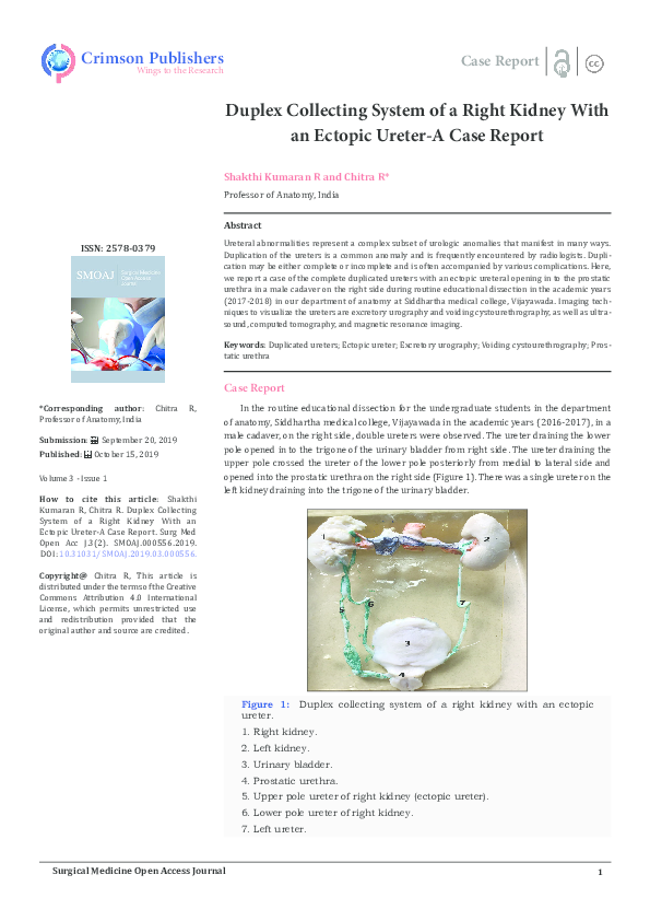 (PDF) Duplex Collecting System of a Right Kidney With an Ectopic Ureter ...