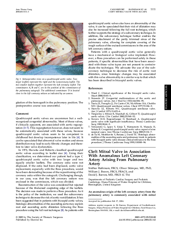 (PDF) At Ross-Konno Operation in an Infant with a Quadricuspid ...