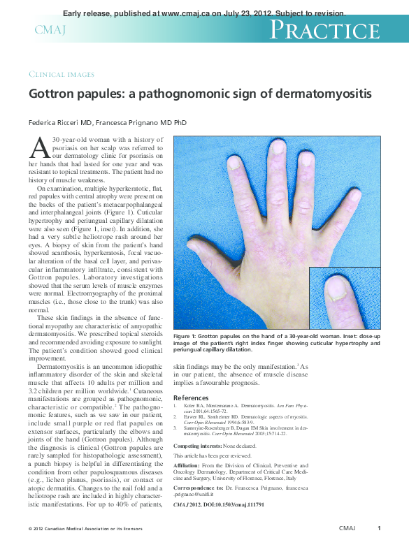 (PDF) Gottron papules: a pathognomonic sign of dermatomyositis