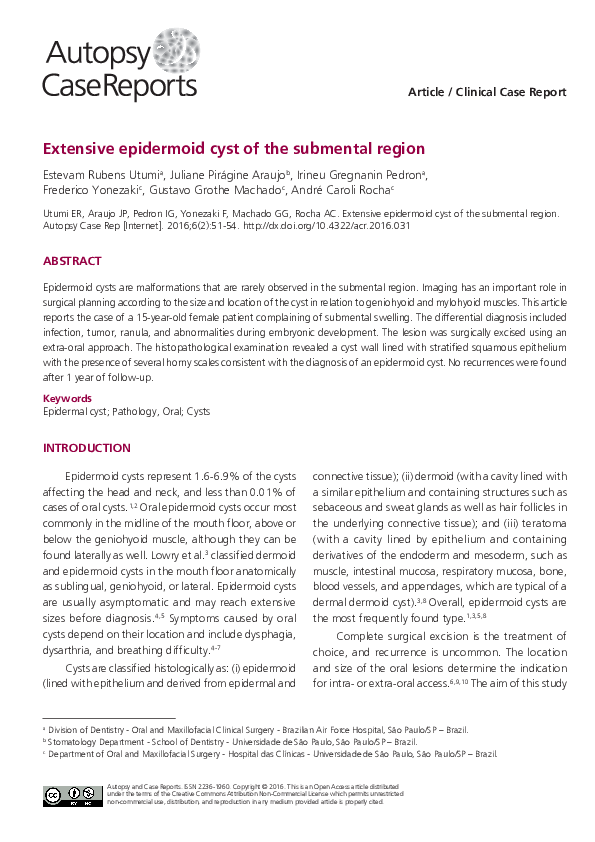 (PDF) Extensive epidermoid cyst of the submental region