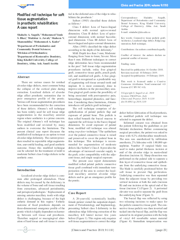(PDF) Modified roll technique for soft tissue augmentation in ...
