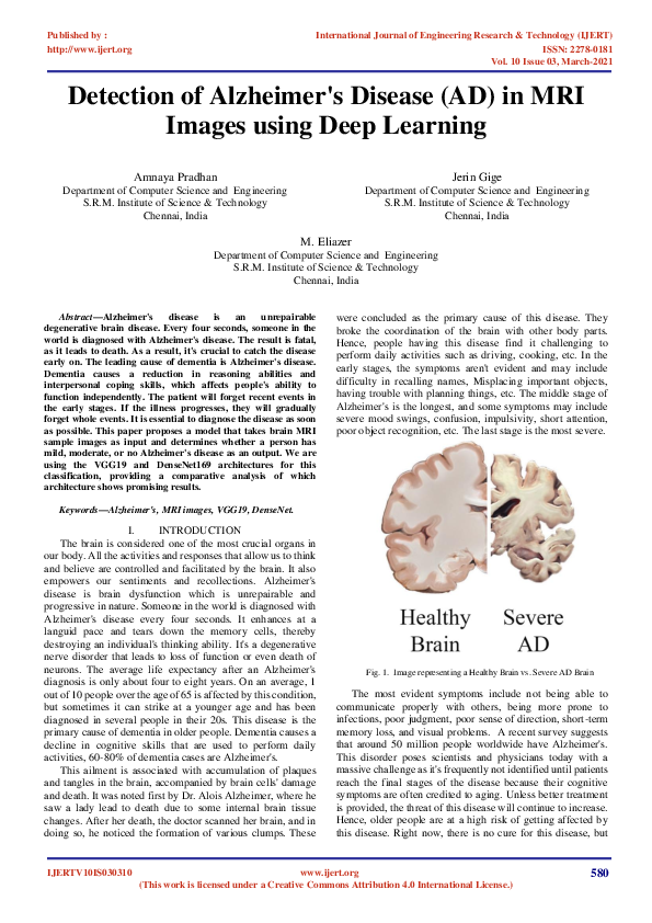 Pdf Ijert Detection Of Alzheimers Disease Ad In Mri Images Using Deep Learning