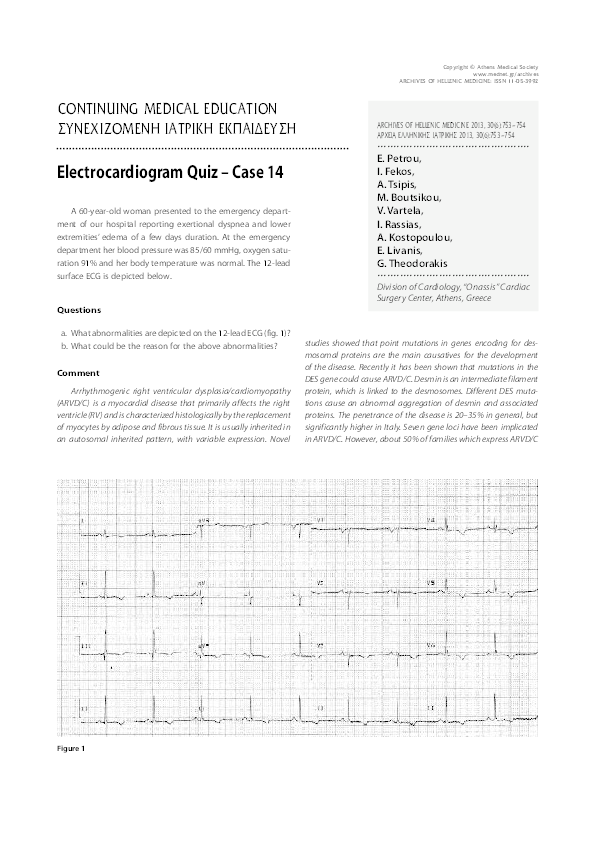 (PDF) Electrocardiogram Quiz – Case 14: Arrhythmogenic right ventricular dysplasia ...