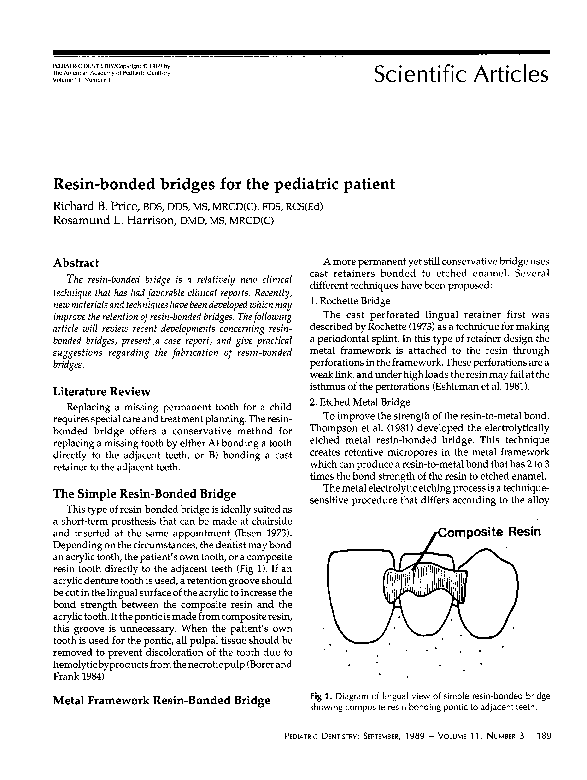 (PDF) Resin-bonded bridges for the pediatric patient