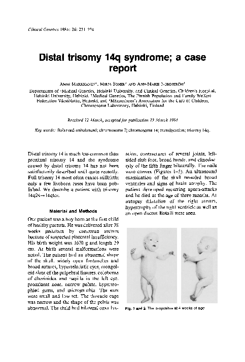 (PDF) Distal trisomy 14q syndrome; a case report