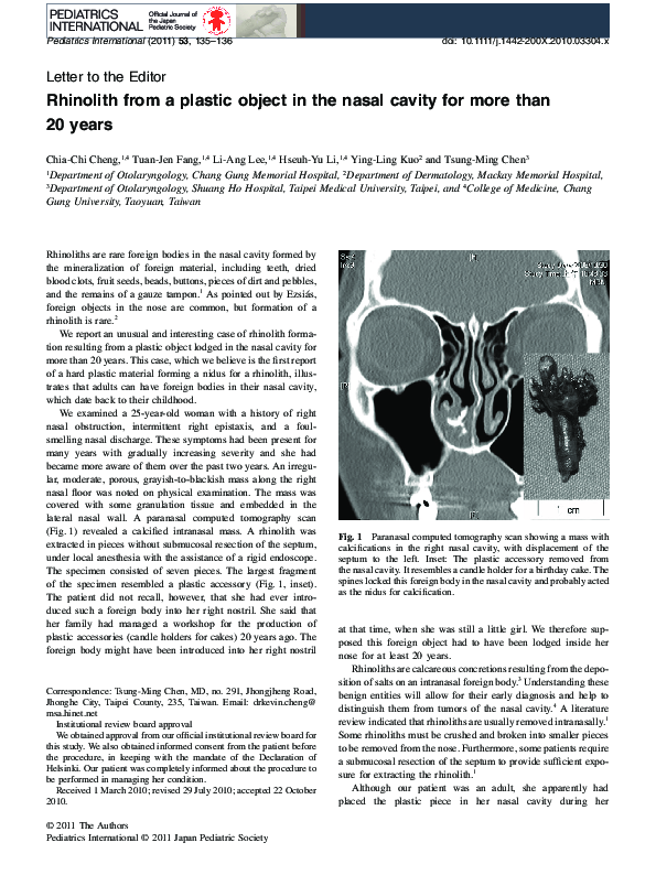 (PDF) Rhinolith from a plastic object in the nasal cavity for more than ...