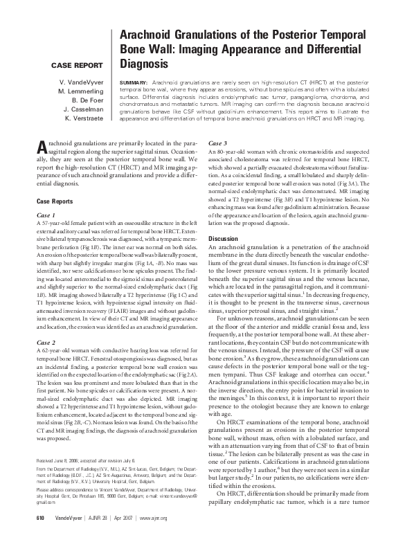 (PDF) Arachnoid granulations of the posterior temporal bone wall ...