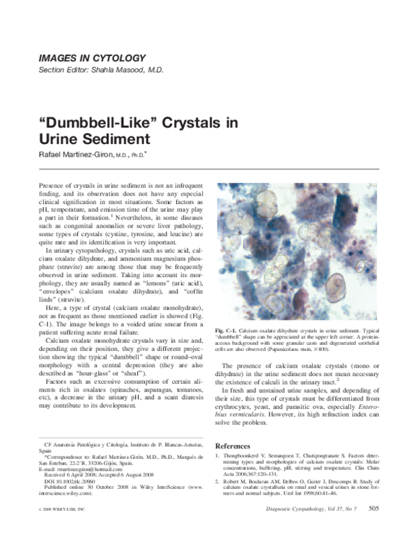 (PDF) “Dumbbell-like” crystals in urine sediment