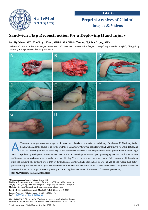 (PDF) Sandwich Flap Reconstruction for a Degloving Hand Injury