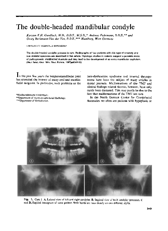 (PDF) The double-headed mandibular condyle