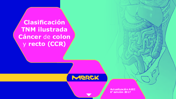 (PDF) Clasificación TNM ilustrada Cáncer de colon y recto ( CCR ...