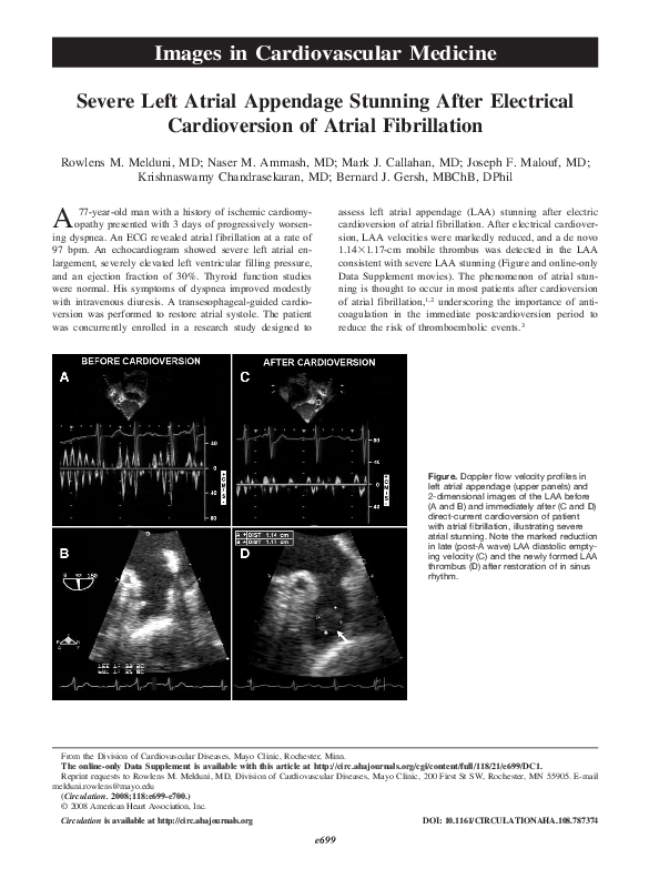 (PDF) Fibrillation Severe Left Atrial Appendage Stunning After ...