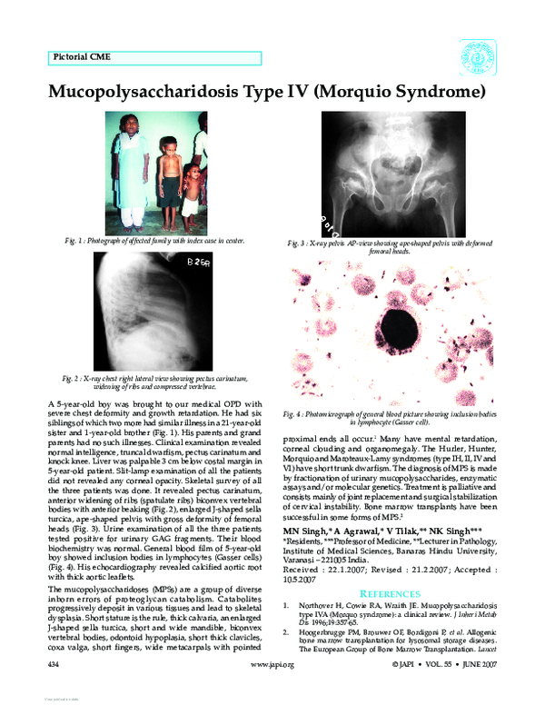 (PDF) [Mucopolysaccharidosis type IV. Morquio syndrome]