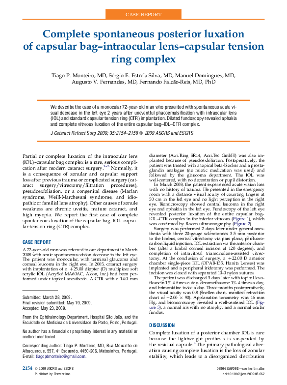 (PDF) Complete spontaneous posterior luxation of capsular bag ...
