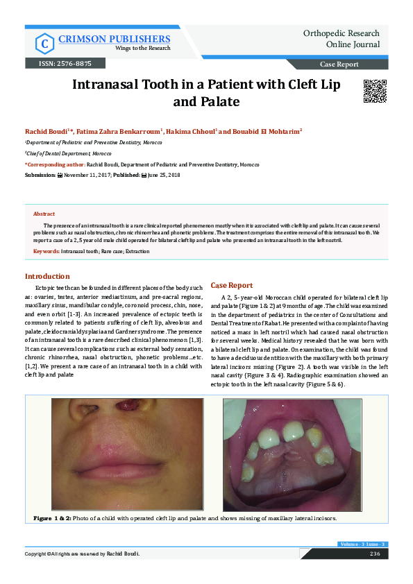 (PDF) An intranasal tooth in a patient with a cleft lip and palate ...