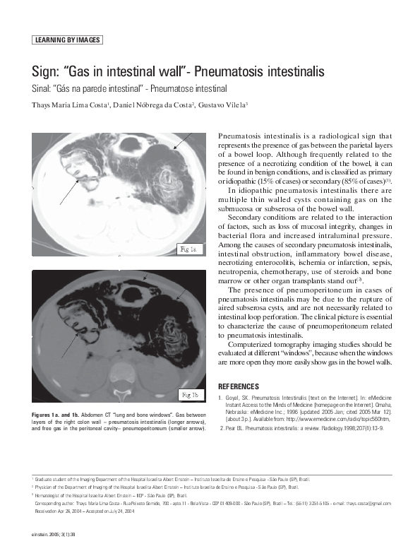 (PDF) Sign: "Gas in intestinal wall"- Pneumatosis intestinalis Sinal ...