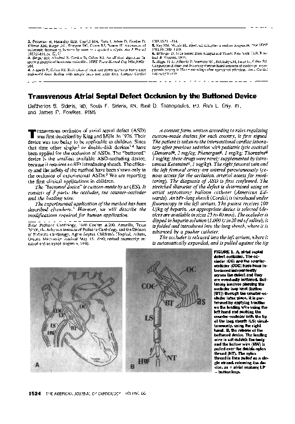 (PDF) Transvenous atrial septal defect occlusion by the buttoned device