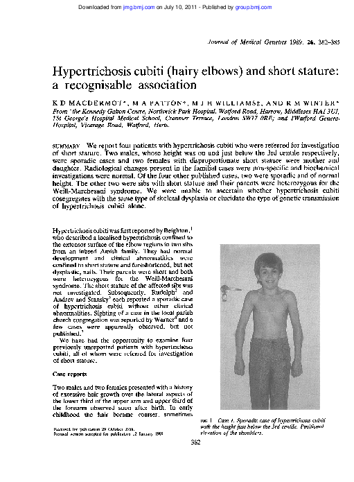 (PDF) Hypertrichosis cubiti (hairy elbows) and short stature: a ...