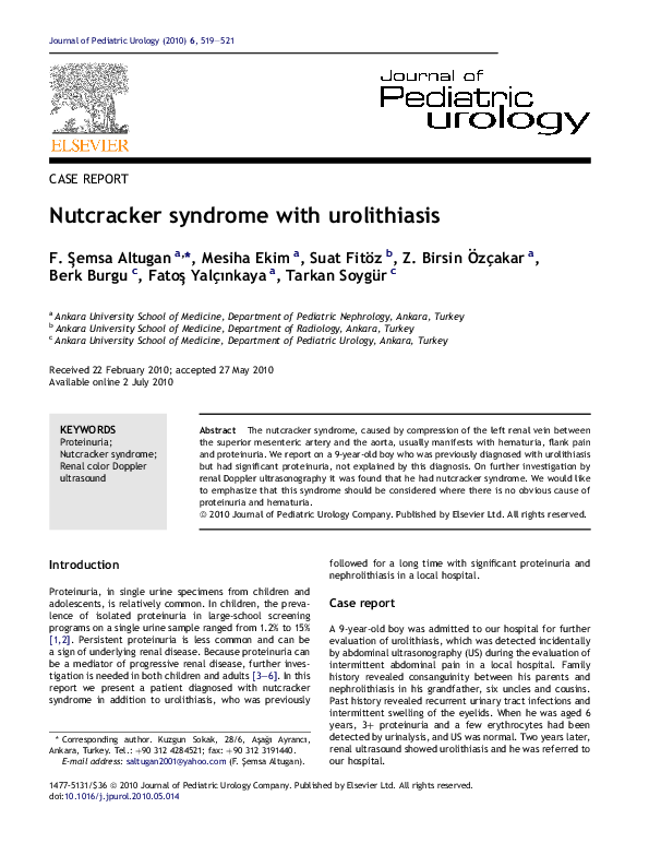 (PDF) Nutcracker syndrome with urolithiasis