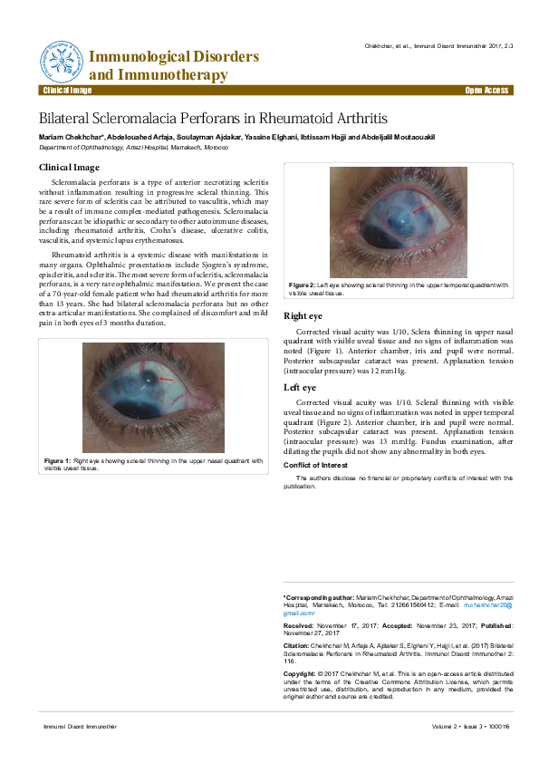 (PDF) Bilateral Scleromalacia Perforans in Rheumatoid Arthritis ...