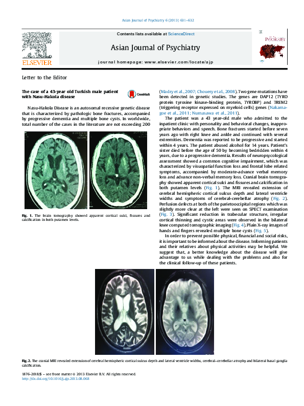 (PDF) The case of a 43-year old Turkish male patient with Nasu-Hakola ...
