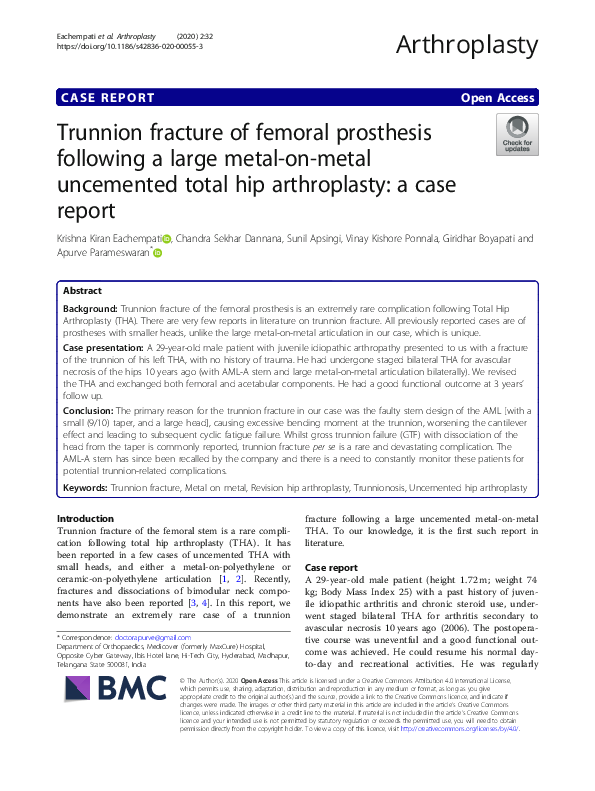 (PDF) Trunnion fracture of femoral prosthesis following a large metal ...