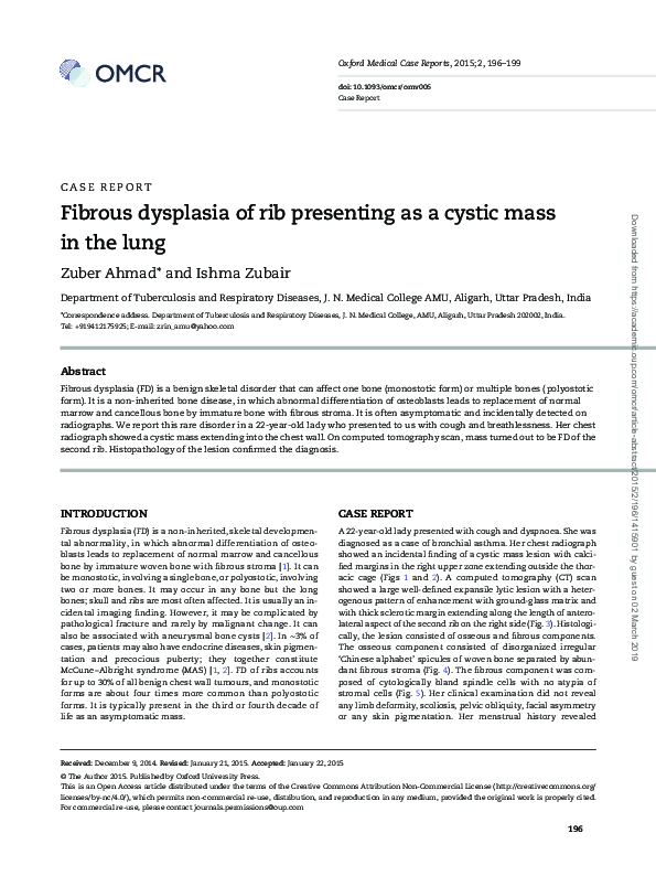 (PDF) Fibrous dysplasia of rib presenting as a cystic mass in the lung