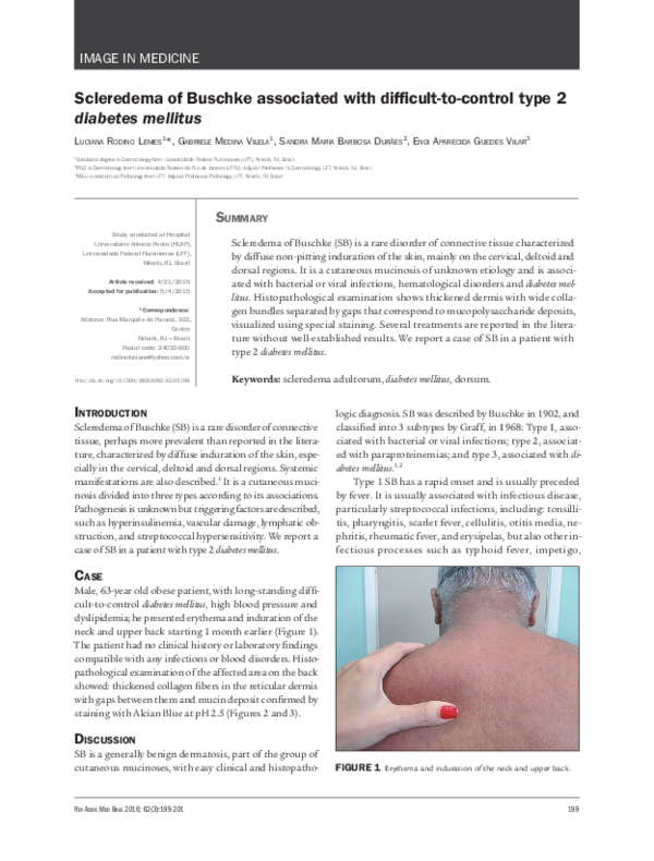 (PDF) Scleredema of Buschke associated with difficult-to-control type 2 ...