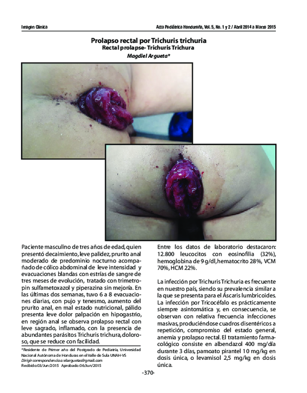 (PDF) Prolapso rectal por Trichuris trichuria