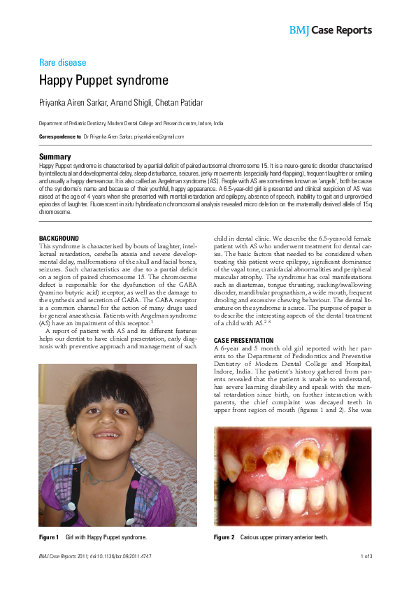 (PDF) Rare disease: Happy Puppet syndrome | chetan Patidar - Academia.edu